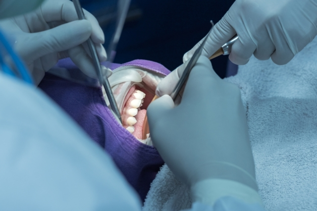 METEOFOR: Say goodbye to dentures: science close to growing new teeth